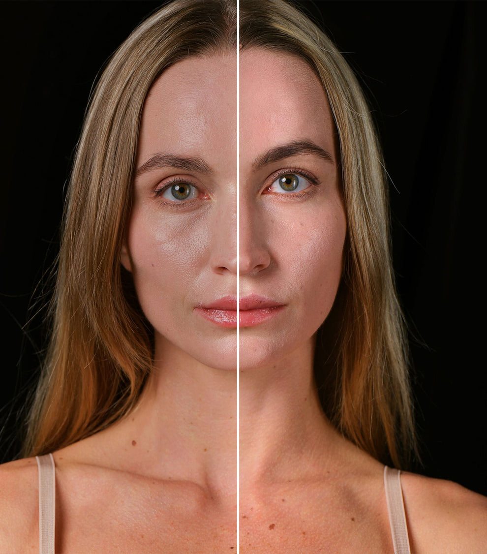 402 Dual Microcurrent Red LED Toning Device - Beauty Trending Now - Feniel